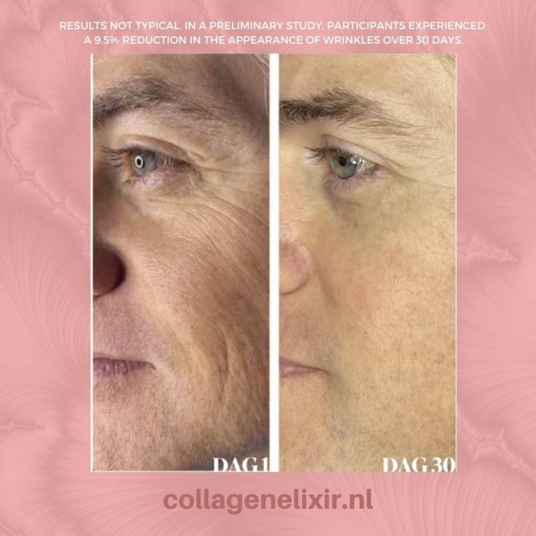 Collagen Elixir – The Little Bottle of Amazing