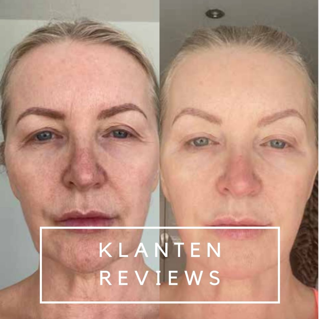 Collagen Elixir – The Little Bottle of Amazing